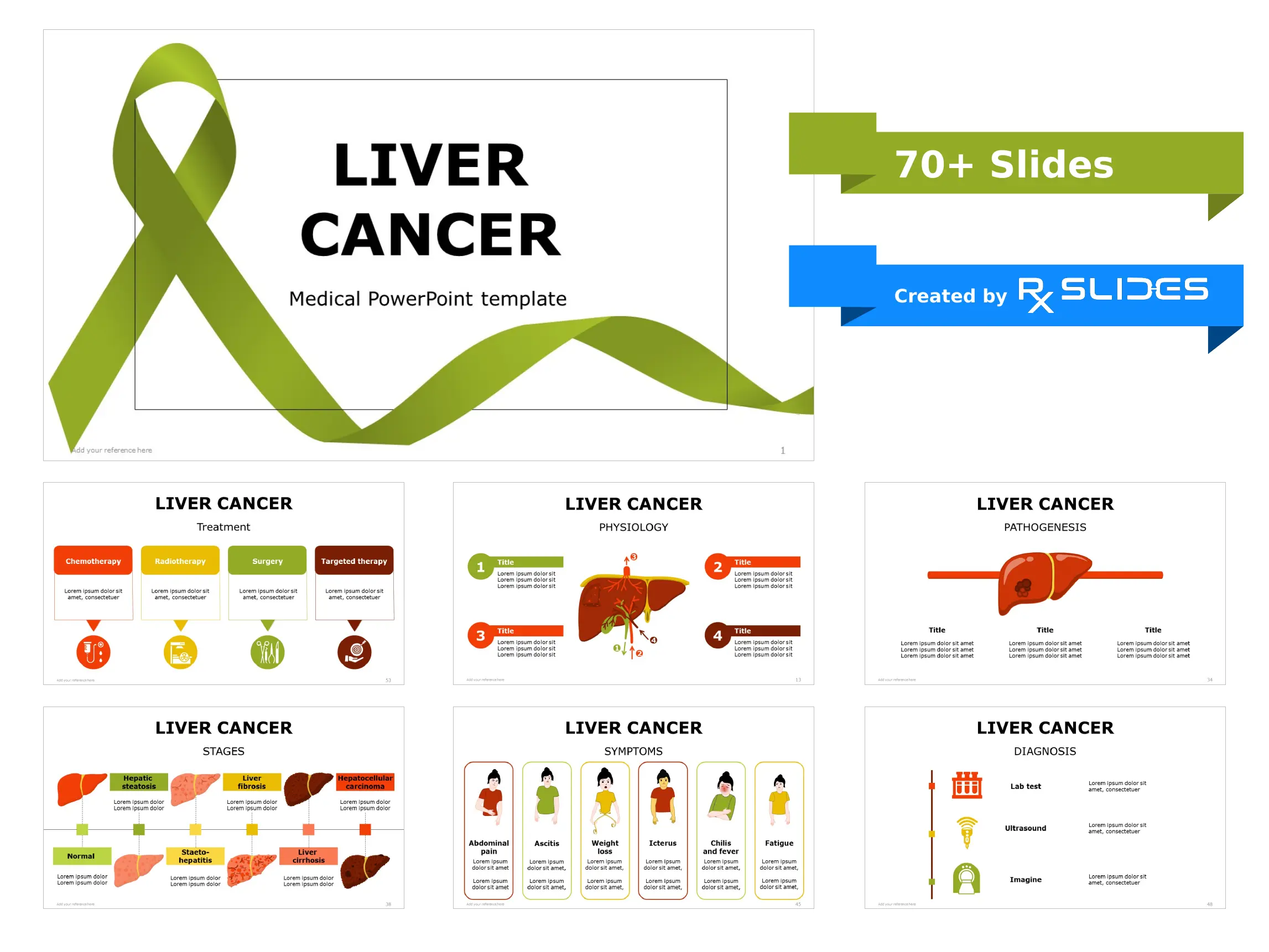 Download liver Cancer PowerPoint Template|